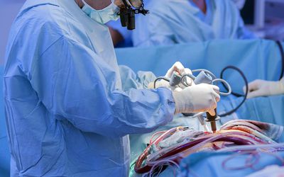 Surgical Site Infections After Cardiac Surgey – Infectious Diseases ...